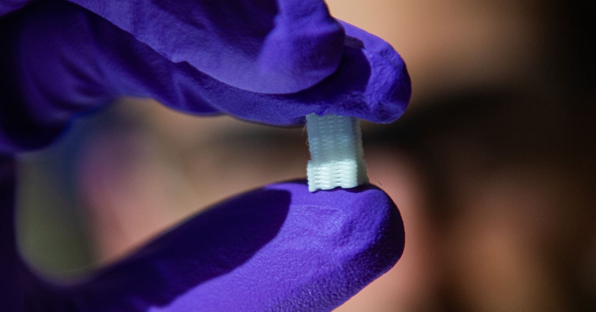 3D – Printing New Body Parts Treat Athletes’ Injuries - MobyGeek.com